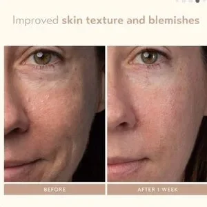 Shani Darden | Skincare | New Shani Darden Lactic Acid Exfoliating ...